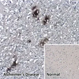 神经退行性疾病 | GeneTex中文官方网站